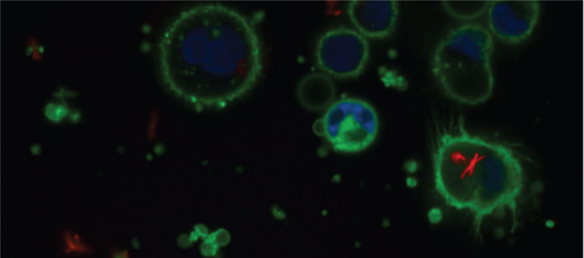 New strategy to reveal the pathogenesis of emerging pathogens (Boeck Lab) | Department of ...